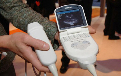 Siemens shows off new Acuson P10 portable ultrasound device - Core77